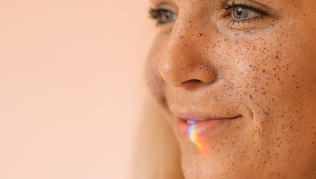 Decoding the Intricate Relationship Between Iron and Skin Pigmentation